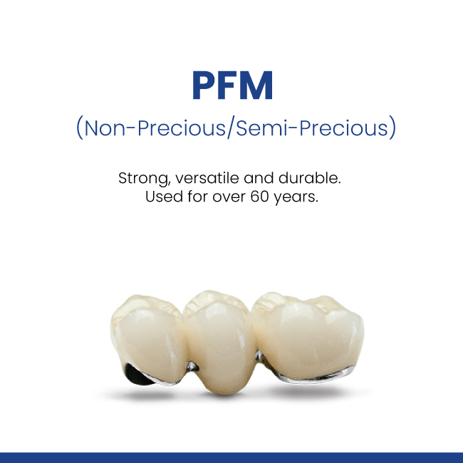PFM(Non-Precious/Semi-Precious) – ARUM Milling Centre